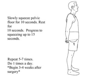 Post Prostatectomy Excercises - Urology San Antonio
