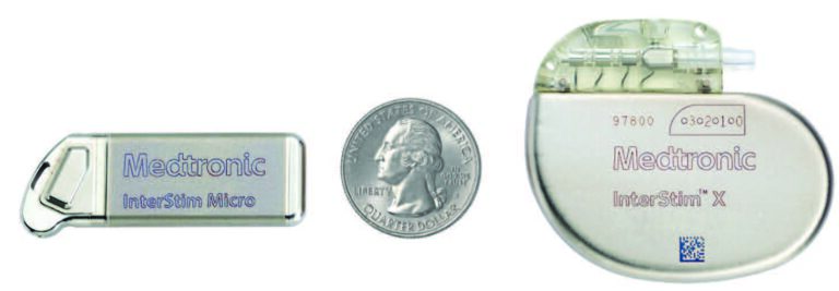 InterStim for Overactive Bladder - Effectiveness for OAB